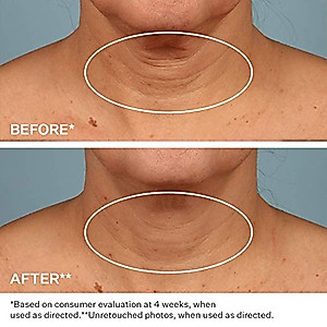 StriVectin TL Advanced Tightening Neck Cream PLUS, 1.7 Fl Oz Ã‚