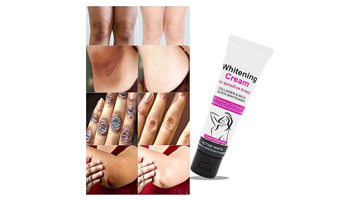 Acclyd Dark Spot Corrector Skin Lightening Cream for Body, Intimate Areas, Underarms, Armpit ...