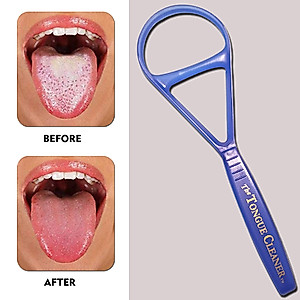 Tongue Scraper Cleaner - the Tongue Cleaner - End Bad Breath and Freshens Breath - Eliminate Bad Breath - Bad Breath Treatment (Color May Vary)