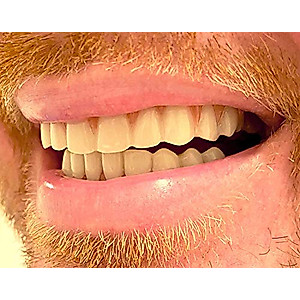 Instant Smile Comfort Fit Flex Teeth - Upper and Lower Matching Set, Natural Shade! Fix Your Smile at Home Within Minutes!