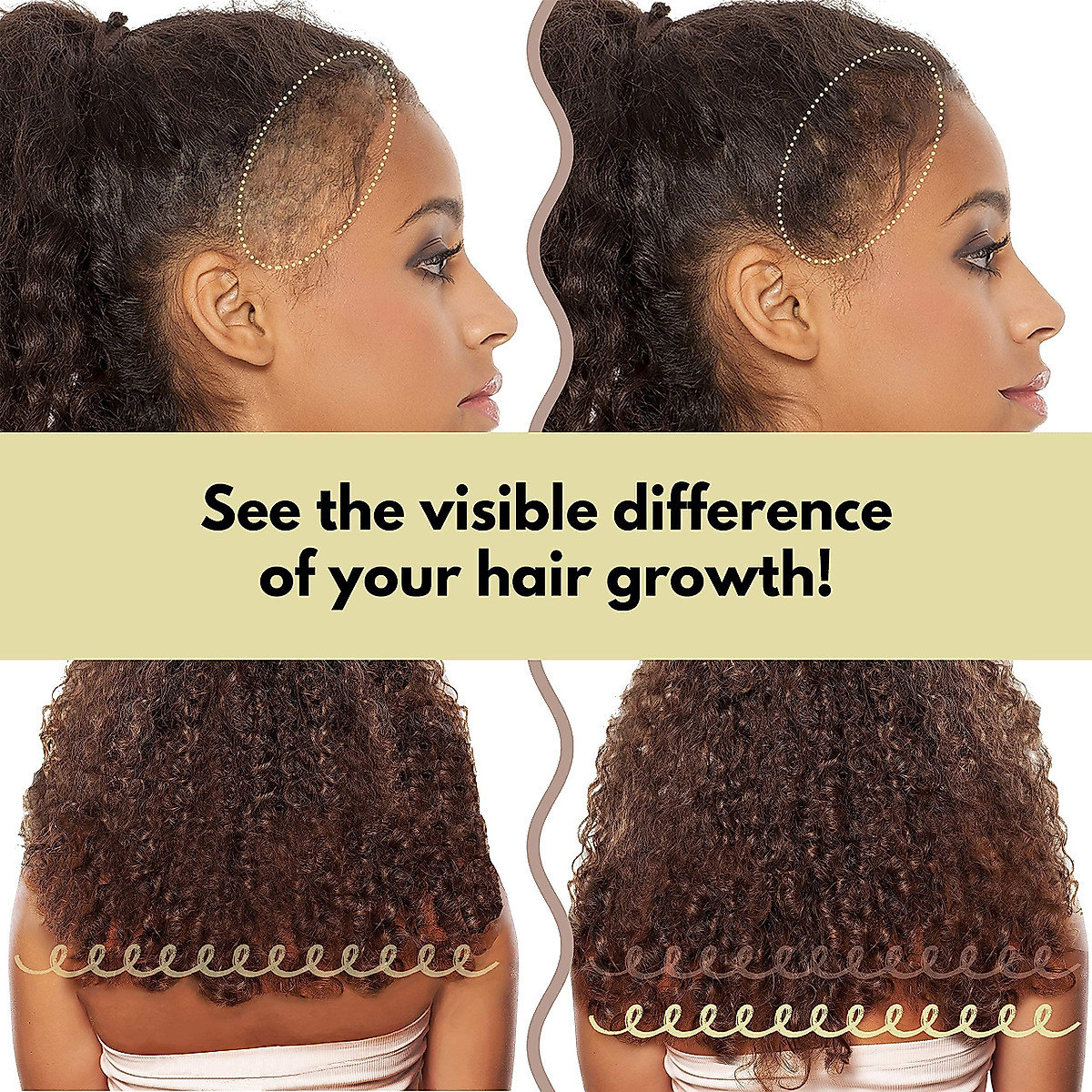 mimosu Rice Water for Hair Growth Shampoo and Conditioner, 2 in 1 Fermented Rice Water Cleansing Shampoo Bar & Conditioning DIY Kit, Curly Girl Method, Self Care Products