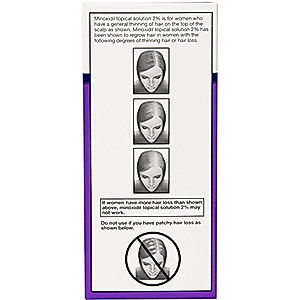 Equate - Hair Regrowth Treatment for Women with Minoxidil 2%, 3 Month Supply( 3 - 2oz bottles ) by Equate