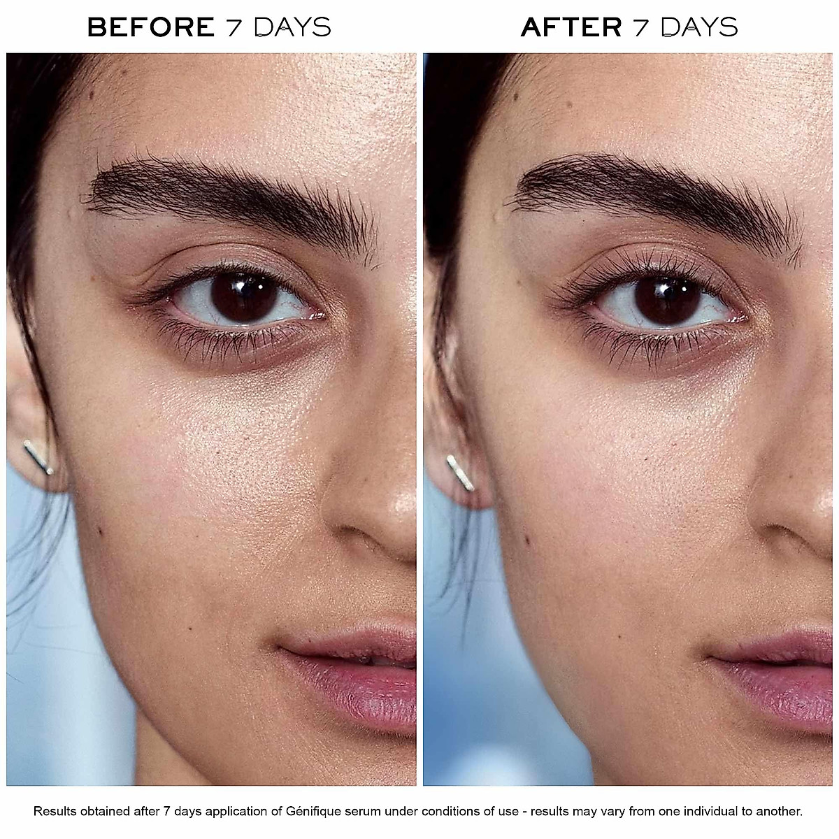 Lancôme Advanced Génifique Radiance Boosting Anti-Aging Face Serum - Visibly Hydrates & Plumps Skin - with Bifidus Prebiotic, Hyaluronic Acid & Vitamin Cg, 1.7 Fl Oz