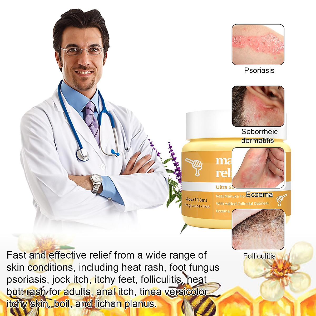 UEUEKOKO Eczema Psoriasis Manuka Relief Honey Cream, Hand Foot, Tinea Versicolor, Itchy Feet, Butt, Anal Itch, Scalp Dandruff, Bee Sting, Bites, Boil Cyst, Armpit, Adults Kids, Hidradenitis Treat