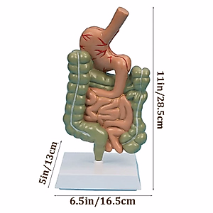 PAASHE Anatomy Model Human Stomach Anatomy Model Organs Model Human Body Model Stomach Section Large Small Intestine Medical Model Study Education