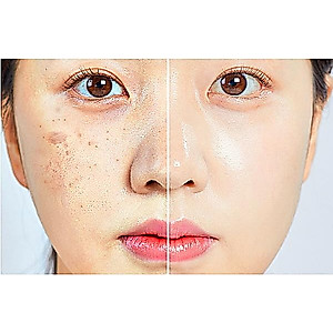 WHITESILK(𝟐𝟎𝟐𝟒 𝐔𝐩𝐠𝐫𝐚𝐝𝐞𝐝) Anti-Aging Skin Boosting SCM75 + HGF (Advanced +) Human Stem Cell 750,000ppm Super Ampoule, with SCM-3D Biomimetic Technology (10ml x 5 vials, 1.69oz)