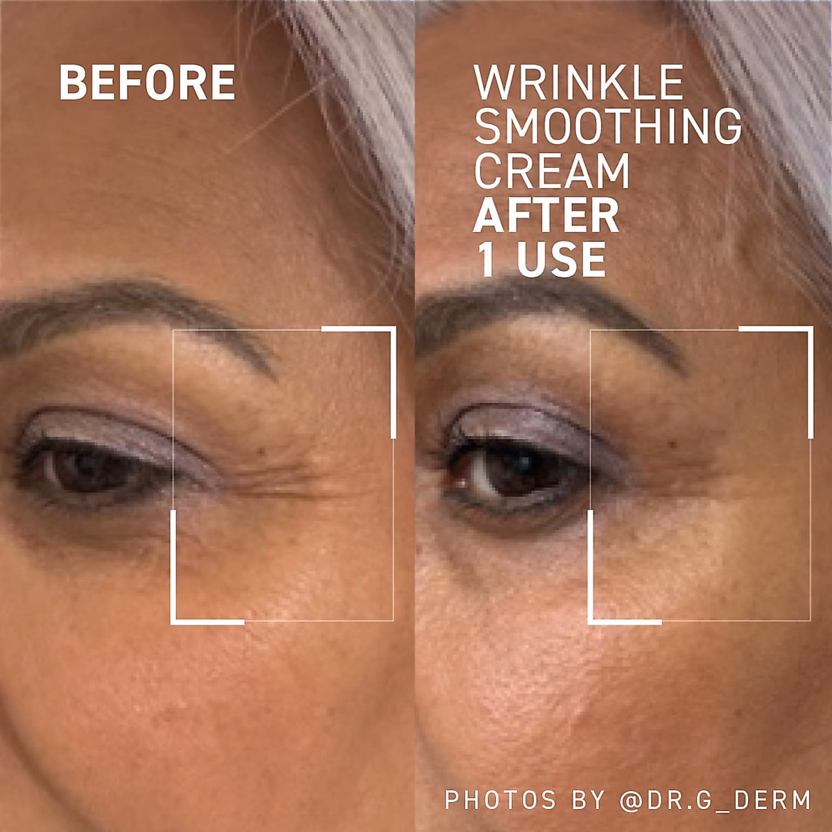 Dr. Brandt Needles No More Wrinkle Smoothing Cream - Smooths Expression Lines, Firms & Protects the Skin - 0.5 oz