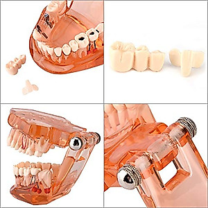 Maxmartt Teeth Model, Dental Demonstration Dental Implant Removable Study Model Teeth Teaching Model for Student Teacher, Orange