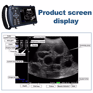 Aopuoe Portable Ultrasound Scanner for Veterinary, with 3.5Mhz Convex Probe, for Pig/Dog/Sheep/Tiger/Bear/and Other Medium-Sized Animals Use