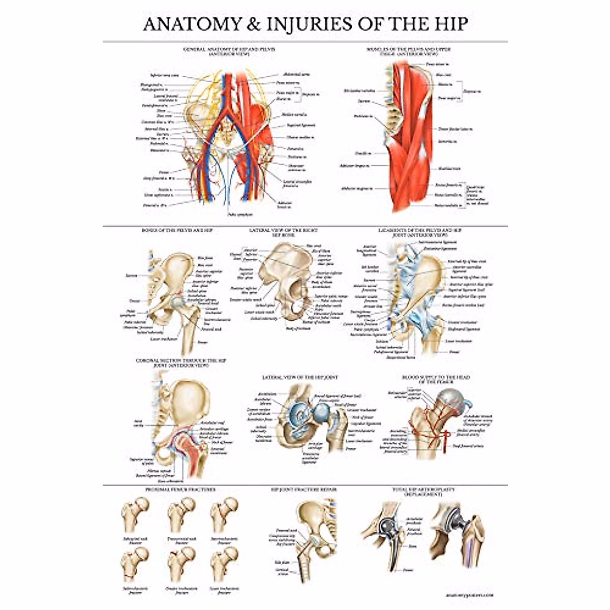 Palace Learning Laminated Anatomy and Injuries of the Hip Poster - Hip Joint Anatomical Chart - 18" x 24"