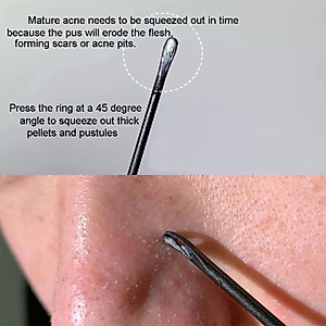 ALIOBC Disposable Cotton Swabs Stick,160 Pcs Multi Use Black Double-Headed Acne Squeezing Professional Ear Pick for Blackhead or Whitehead Nasal Gunk Removerand Clean Skin Pores