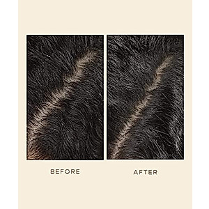 VEGAMOUR GRO Scalp Detoxifying Serum, 2 FL Ounce