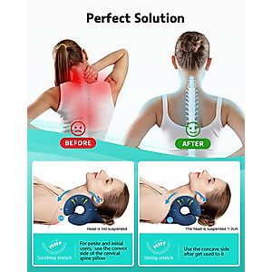 Neck and Shoulder Relaxer - Neck Stretcher Cervical Spine Traction Device to Relieve Neck and Shoulder Fatigue and Pain, Chiropractic Pillow for Relief TMJ Pain Headache Muscle Relax Spine (Dark Blue)