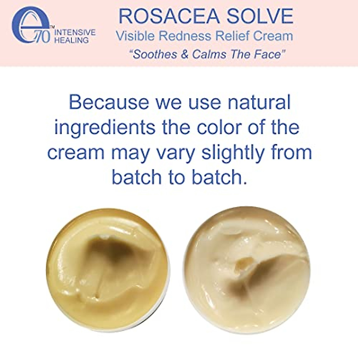 E70 Rosacea Solve - Redness Relief Cream - Calming Face Moisturizer For Rosacea and Acne-Prone Skin - Sensitive Skin Care With Organic Ingredients such as Aloe Vera, Almond Oil, Licorice and Chamomile Extracts - No Parabens