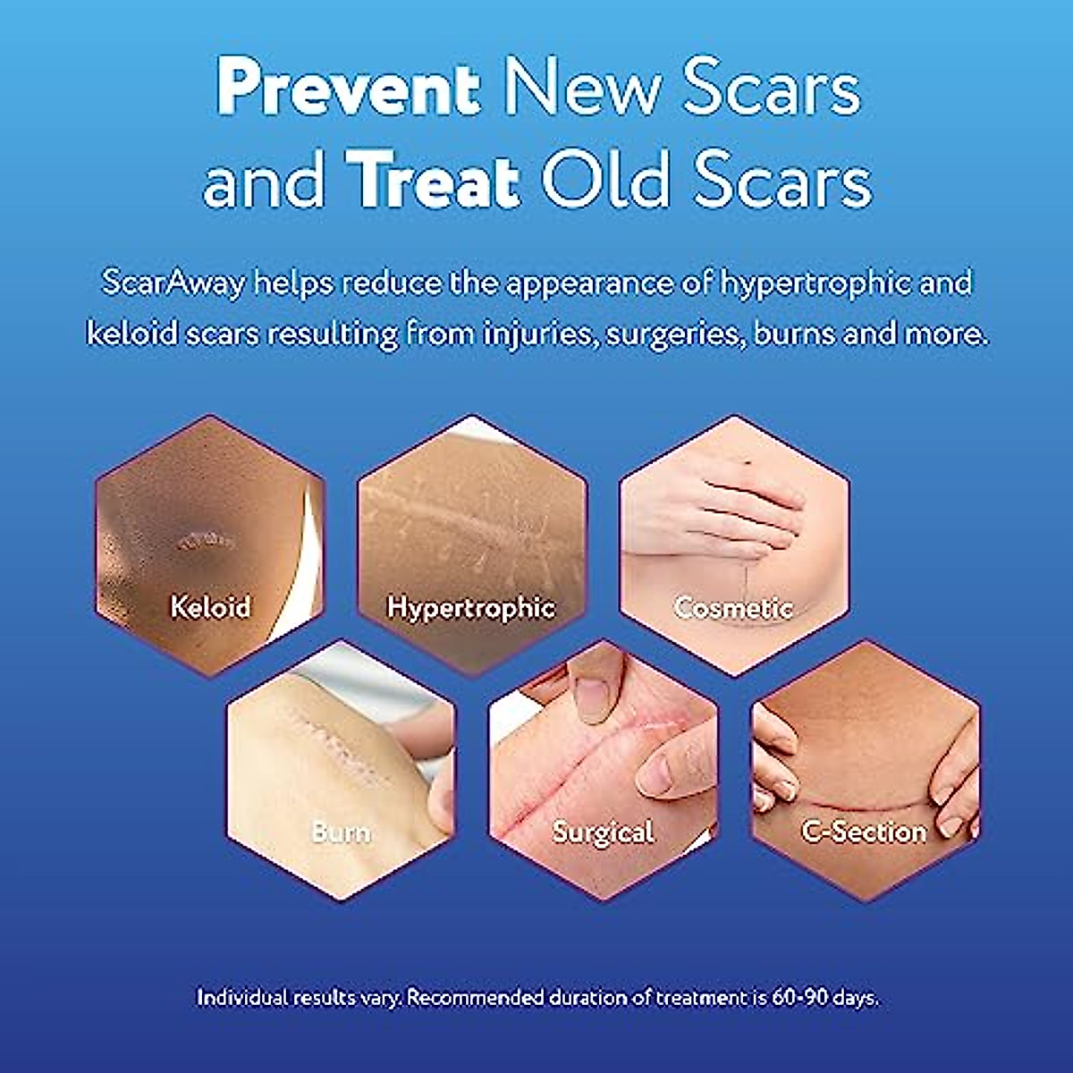 ScarAway Silicone Scar Gel, Helps Improve Size, Color & Texture of Hypertrophic & Keloid Scars from Injury, Burns & Surgery, Water Resistant, 10g (0.35 Oz)