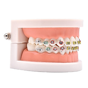 Angzhili 1 Piece Dental Demonstration Orthodontic Model with Metal Wires and Bracket (Metal bracket)
