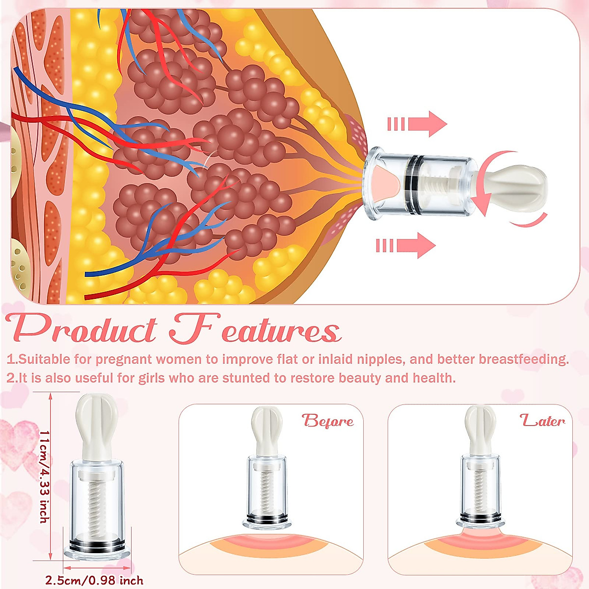 BBTO 8 Pieces Nipple Suction Cups Nipple Corrector Sucker Nipple Pullers Aspirator Women Nipple Flat Inverted for Breastfeeding Silicone with Case (Blue, Pink,1 Inch)