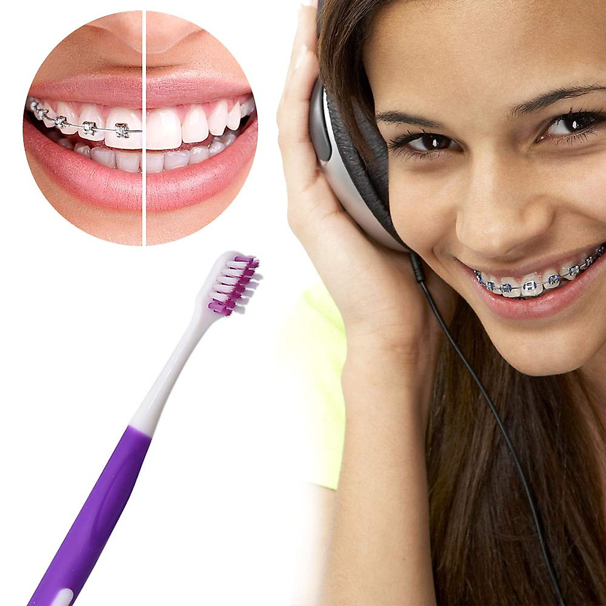 Angzhili Portable Orthodontic Toothbrush Kit for Orthodontic Patient Orthodontic Care Kit for Braces,Interdental Brush,Dental Wax,Dental Floss,Dental Travel Kit(Purple)