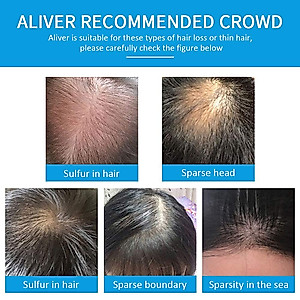 Hair Building Fibers, Hair Thickening Fibers for Thinning Hair & Bald Spots Thicker Fuller Hair in 15 Seconds Suitbable for Man and Woman 0.97Oz(Black)