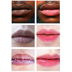 H.D.S.N. Lip Scrub For Dry Lips 20g - Lighten Dark Lips For Smoking Men Women Smoker | Natural Balm Moisturizer Exfoliator Sleeping 0.7 Fl Oz (Pack of 1)