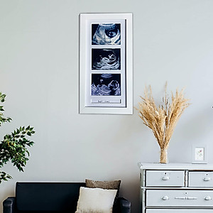 trlry Triple Ultrasound Picture Frames, Sonogram Picture Frame 3 Photos,Pregnancy Announcements,Pregnancy Gifts for First Time Moms,First Time Mom Gift,White,Ultrasound Photo Album