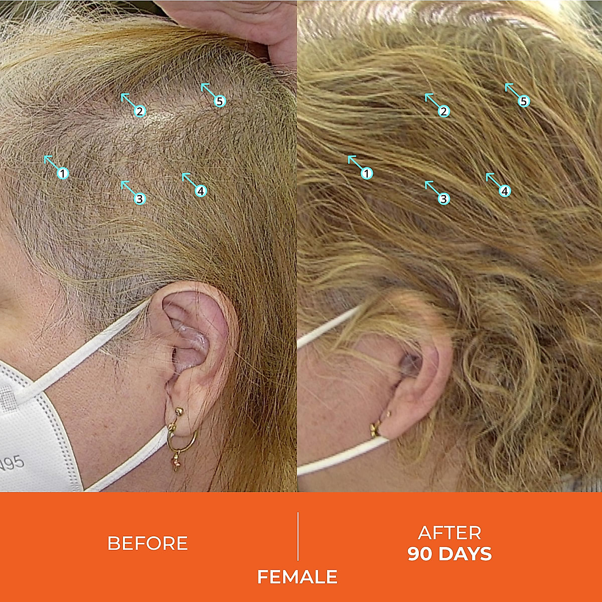 DS Laboratories Revita Tablets, Hair Supplement for Hair Growth Support, Zinc, Iron, Magnesium, Melatonin, Vitamin D & Biotin Vitamins for Women & Men, Hair Vitamins for Thicker Hair Growth, Hair Care