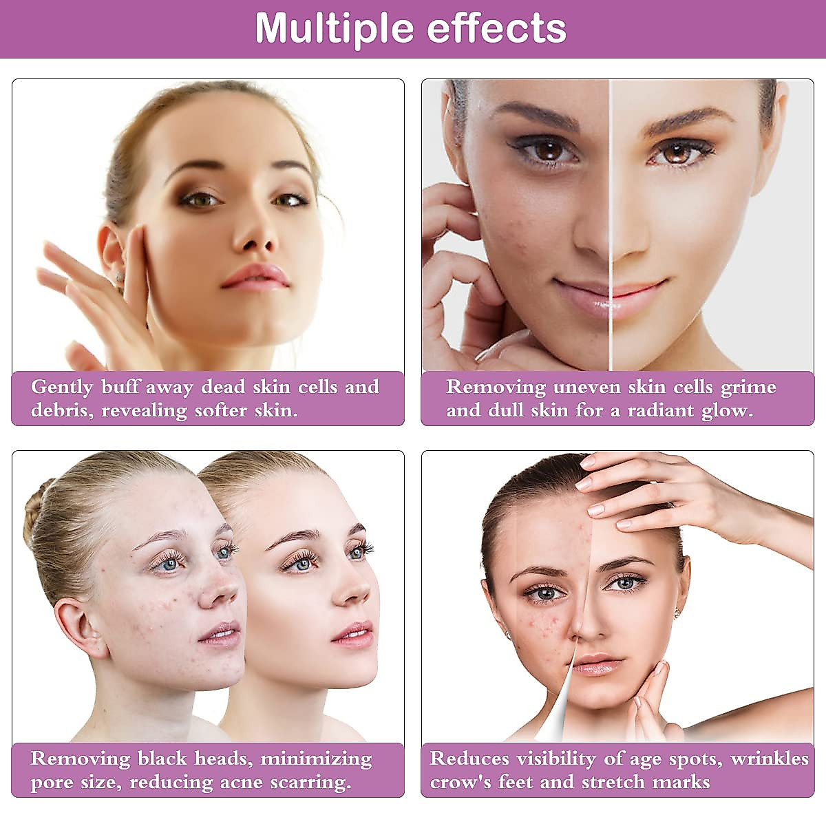 Yofuly Diamond Microdermabrasion Machine, 65-68cmHg Suction Power Professional Dermabrasion, Home Use Facial Skin Care Equipment