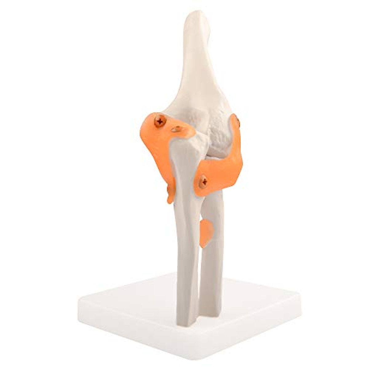 Ultrassist Human Elbow Model with Ligaments, Life Size Elbow Anatomy Model with Study Card, Best Teaching Tool for Patient Education & Anatomy Study
