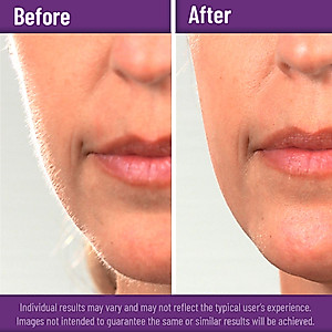 Pack of 100 Surgical Blades 10 Disposable Scalpel Blades, Size 10 Scalpel Blades for Surgical Knife Scalpel handle, High Carbon Steel Dermablade Surgical Blades. Individually Wrapped 10 Blade, Sterile