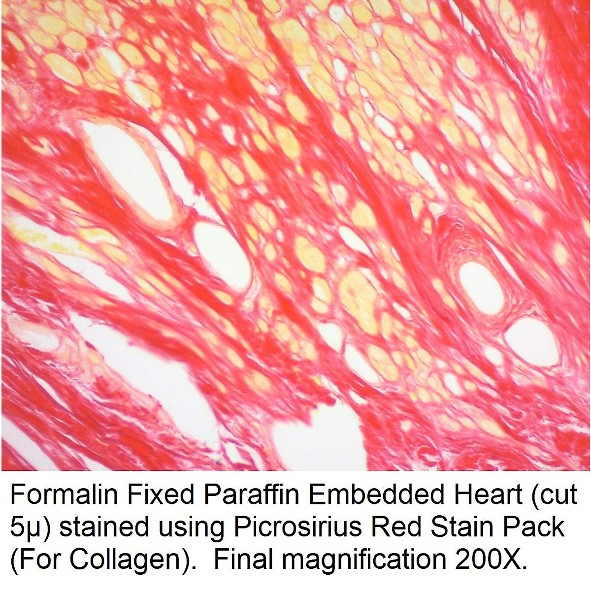Picrosirius Red Stain Pack (for Collagen), 250ml