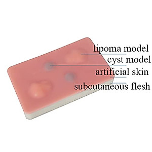 Model Teaching Model Cyst Model Skin Cyst Excision Model Training Suture Pad Skin Model Lipoma Model for Medical Practice for Teaching