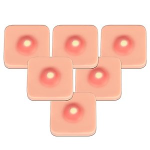 Ultrassist Abscess I&D Incision and Drainage Pad (6-Pack), Sebaceous Cyst Removal Trainer, Suture Practice Skin Pad for Medical Education