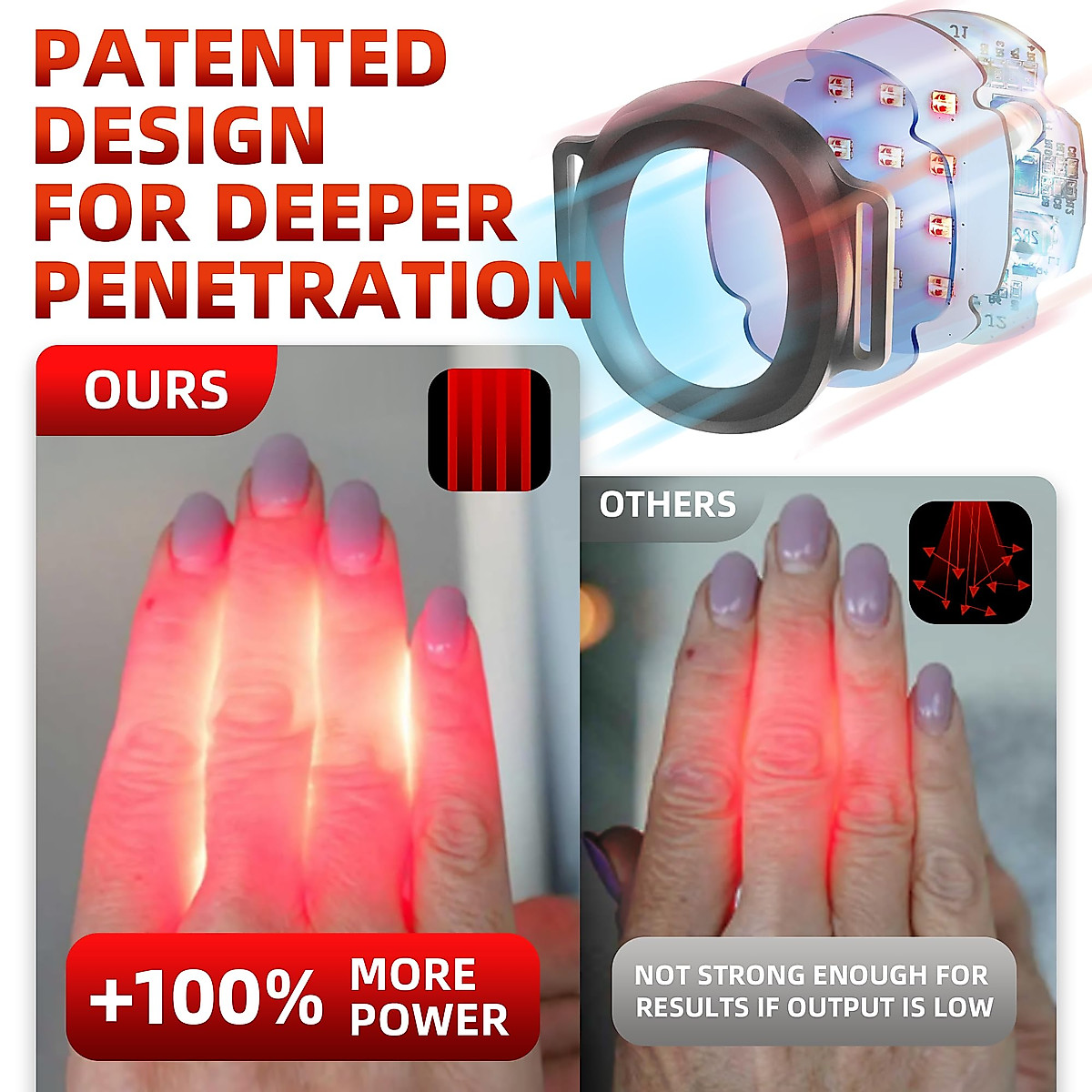 UTK Cold Laser Therapy Device for Dogs, Red Light Therapy for Dogs, Deeper Directly Targeted Pain Relief in Joint, Hip and ACL - Portable Infrared & Red Light with 660nm 850nm for Pets