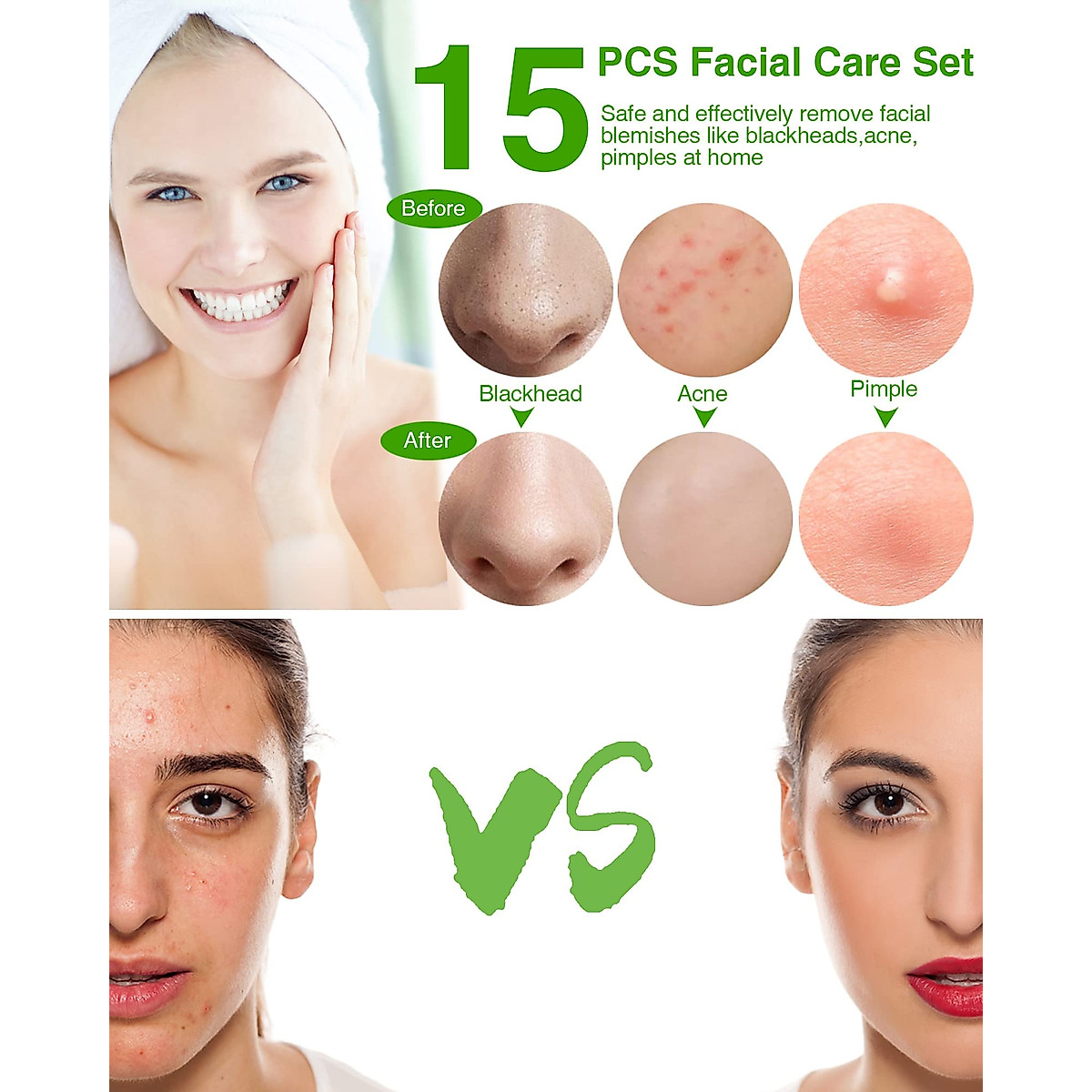 15 PCS Blackhead Remover Pimple Popper Tool Kit,Black Head Removal Extractor for Acne Comedone Whitehead Popping Zit Blemish Facial Skin Care Tools with Metal Case