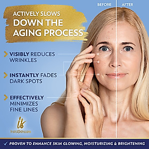 InstaSkincare Renewing Bundle - Hyaluronic Acid Serum for Face 2Oz - Niacinamide Vitamin B3 Facial Serum 2 Oz