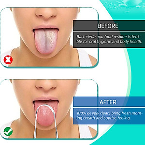 4pcs Tongue Scraper, Tongue Cleaners (1 pcs Stainless Steel, Red Blue Green silicone tounge scrappers), Reduce Bad Breath (Medical Grade), 100% BPA Free Metal Tongue Scrapers Fresh Breath fastly