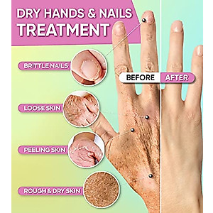 Moisturizing Hand Mask for Dry Cracked Hands & Nails - Hydrating Spa Treatment - Korean Collagen Gloves with Natural Plant Extracts - Nourishing Skin Care Gift with Shea Butter for Women & Men by Elixir