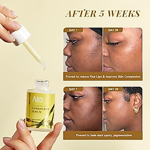 ANAiRUi Vitamin C Turmeric Facial Serum, Face Serum for Dark Spots, Hydrating, Firming & Smoothing Serum For All Skin Types, Wrinkles, Fine Lines, Radiance & Glow 1.05 OZ