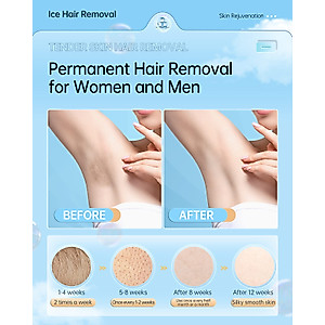 IPL Hair Removal for Women and Men, Permanent Laser Hair Removal with 2 Intelligent Attachments for SR HR, Ice Cooling Painless Hair Removal At Home, 999900 Flashes, Safe for Whole Body
