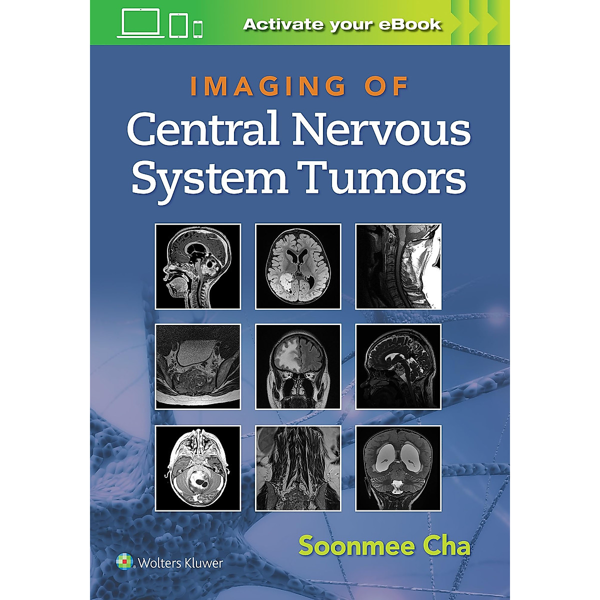 Imaging of Central Nervous System Tumors