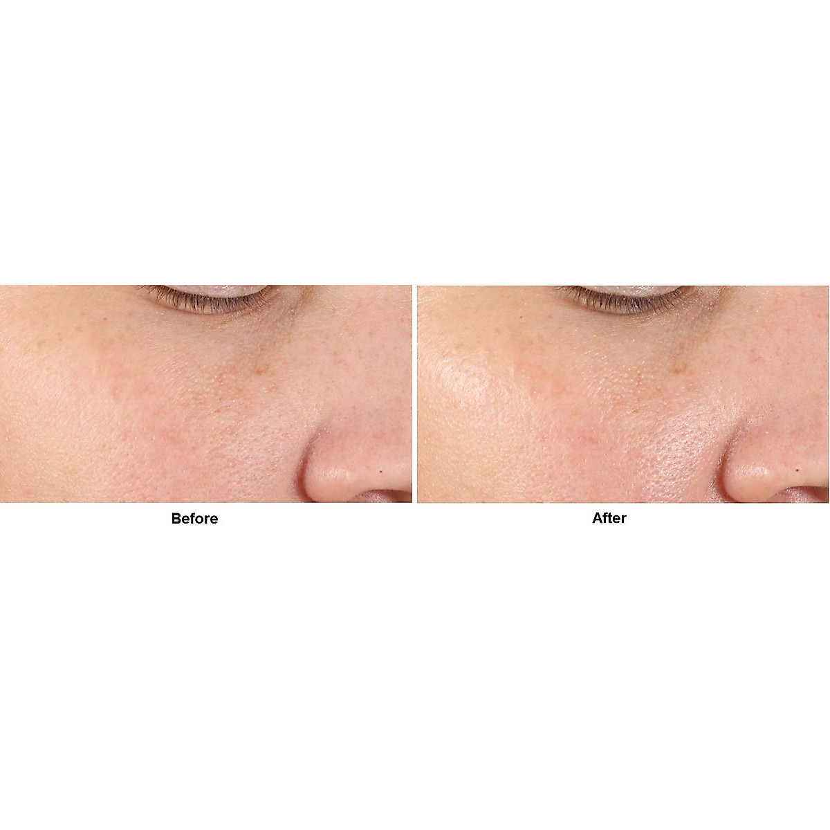 Dr. Dennis Gross Alpha Beta® Pore Perfecting & Refining Serum: for Enlarged, Clogged Pores with Excessive Oil, 1.0 fl oz