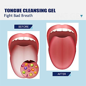 Tongue Cleaning Gel with Tongue Brush,50g Mint Scent Tongue Coating Cleaner Brush Kit,Dental Fresh Breath Cleaning Oral Care Gel Set Removes Oral Odor for Adults Kids (Set, 2PCS)