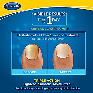 Dr. Scholl's Fungal Nail Treatment Revitalizer LED Light-Activated Therapy, Erase Toenail Discoloration Fungus, 10 ml