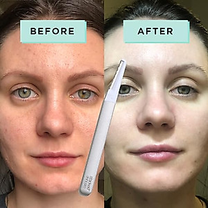 StackedSkincare Dermaplaning Face Exfoliating Tool - Professional-Grade, At-Home, Extra-Sharp Blade to remove Dead Skin and Peach Fuzz - Includes 1 Aluminum Handle and 1 Razor Head (Non-Electric)