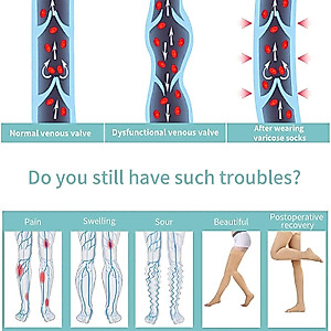 Thigh High 20-32 mmHg Compression Stocking Toeless Compression Socks for women & men circulation with Silicone Dot Band