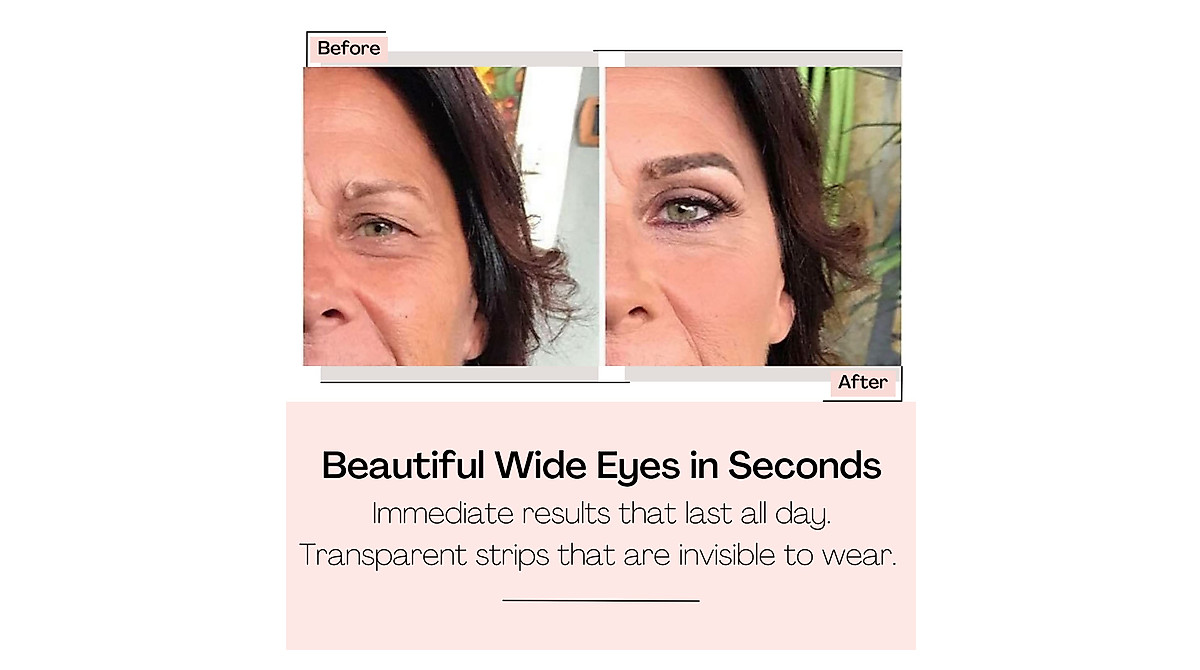 Wonderstripes Eyelid Lifting Strips for Youthful Eyes
