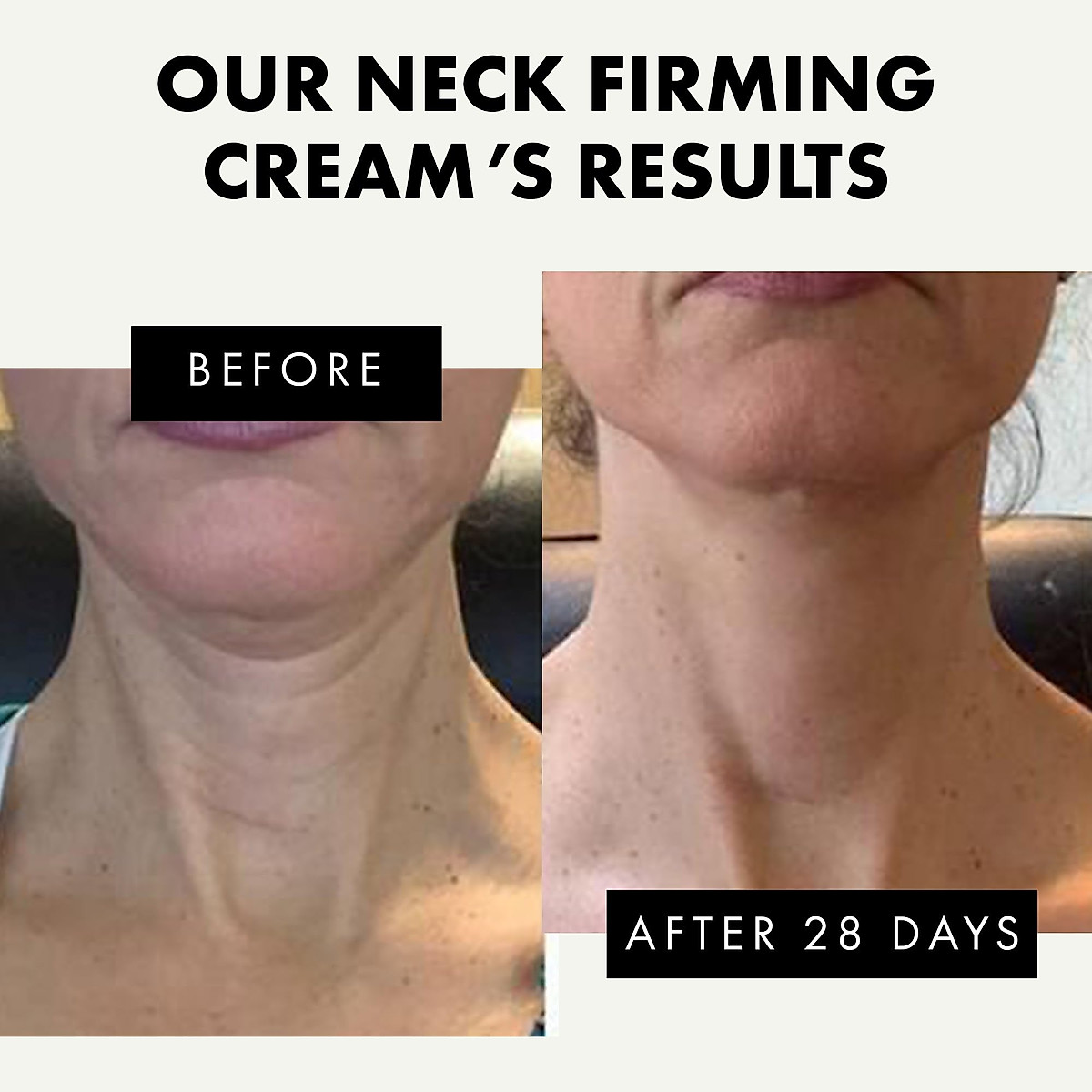 Eclat Skincare Anti Ageing Neck Firming Cream - Natural Skin Tightening Treatment, Anti Wrinkle and Double Chin Reducer - With Vitamin C and E, Green Tea Extract - 100% Vegan, 1.7 oz