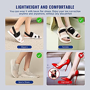 Fitgeno Bunion Corrector Women & Men Big Toe: Foot Straightener Splint Brace - Adjustable Bunyan Correction Orthopedic for Hallux Valgus Pain Relief 2 Pcs
