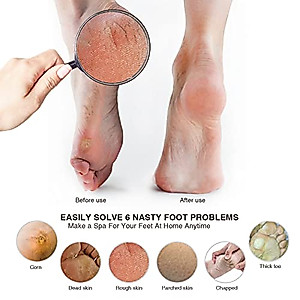 AM 8:00Pumice Stone Foot File, 2 Pack Callus Remover (coarse/fine) for Feet with Wooden Handle, Pedicure Foot Scrubber to Remove Dead Skin, Dry, Rough, Corns Skin Scraper
