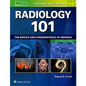 Radiology 101: The Basics and Fundamentals of Imaging